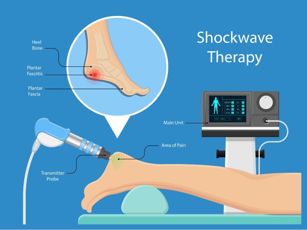 EPAT Therapy: The Non-Invasive Solution for Heel Pain | Central PA EPAT ...